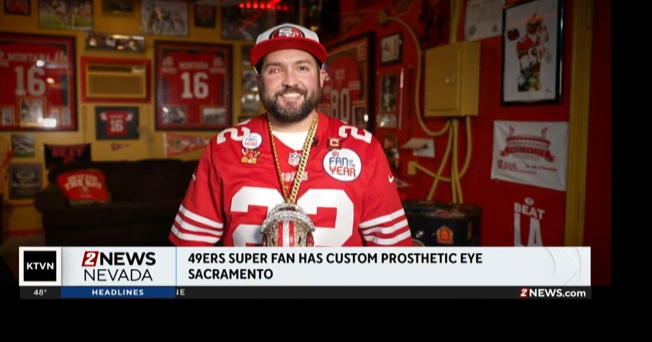 49ers Custom Prosthetic Eye | News | 2news.com