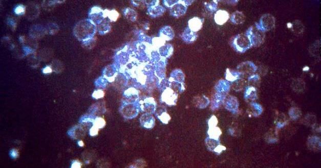 Carson City, Douglas, and Lyon Counties Report 225 Total RSV Cases ...