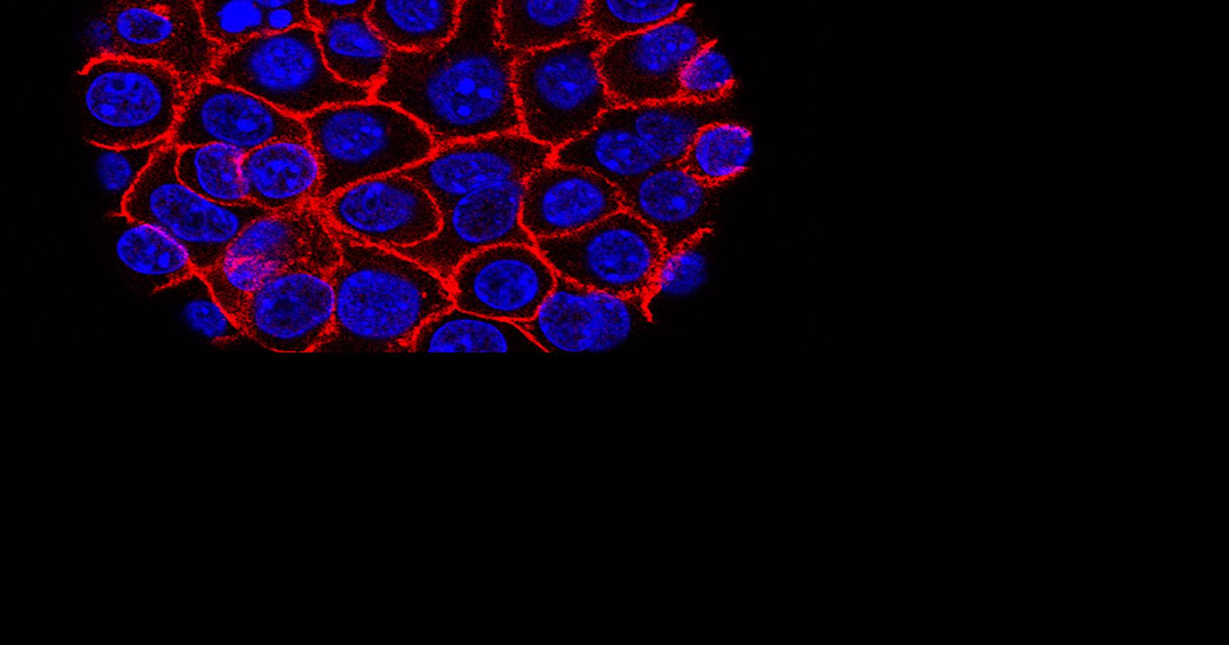 Experimental pill promises new hope for deadly pancreatic cancer ...