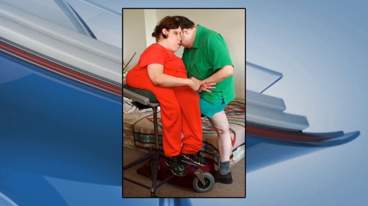 World’S Oldest Conjoined Twins Have Died At The Age Of 62 – MRQOI