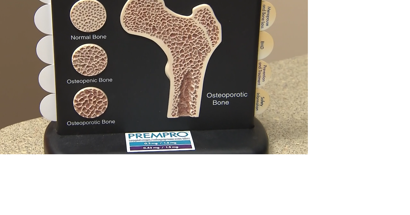 Building stronger bones: Tips from a Chico State Kinesiology Professor ...