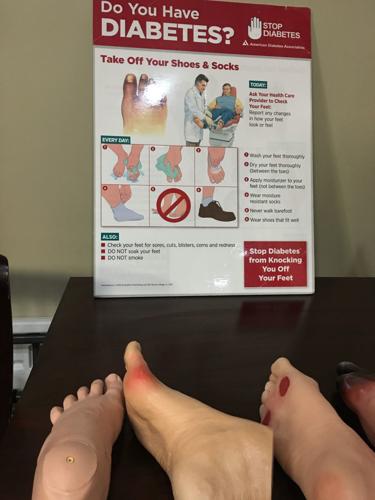 Healthcare - Lions Donate Mirrors For Diabetic Foot Checks | News ...