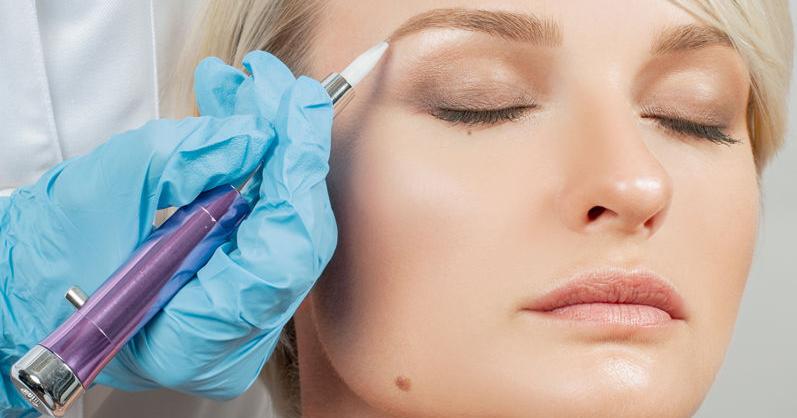Microblading restores, enhances eyebrows after hair loss | Archives ...