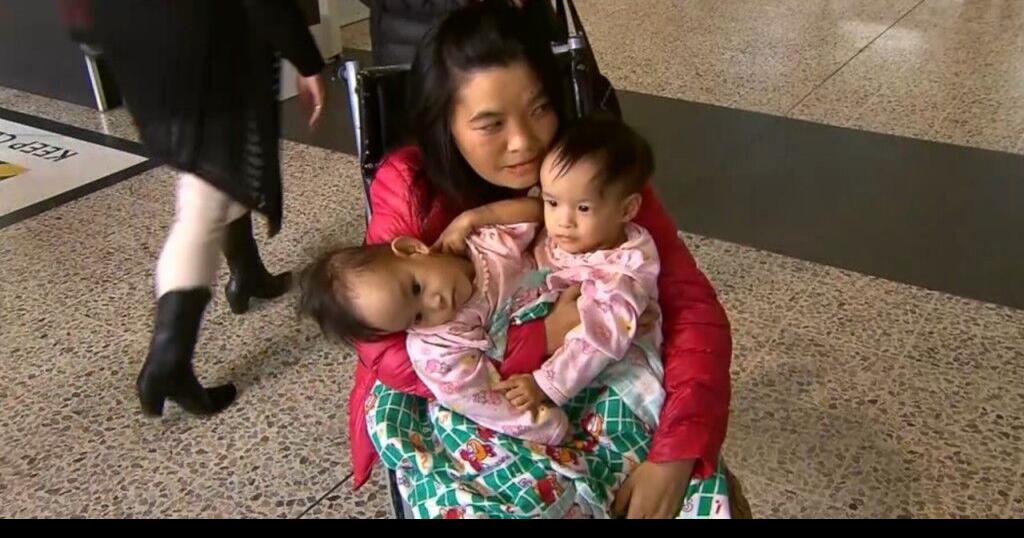 Conjoined twins flown from Bhutan to Australia for operation | Health | applevalleynewsnow.com