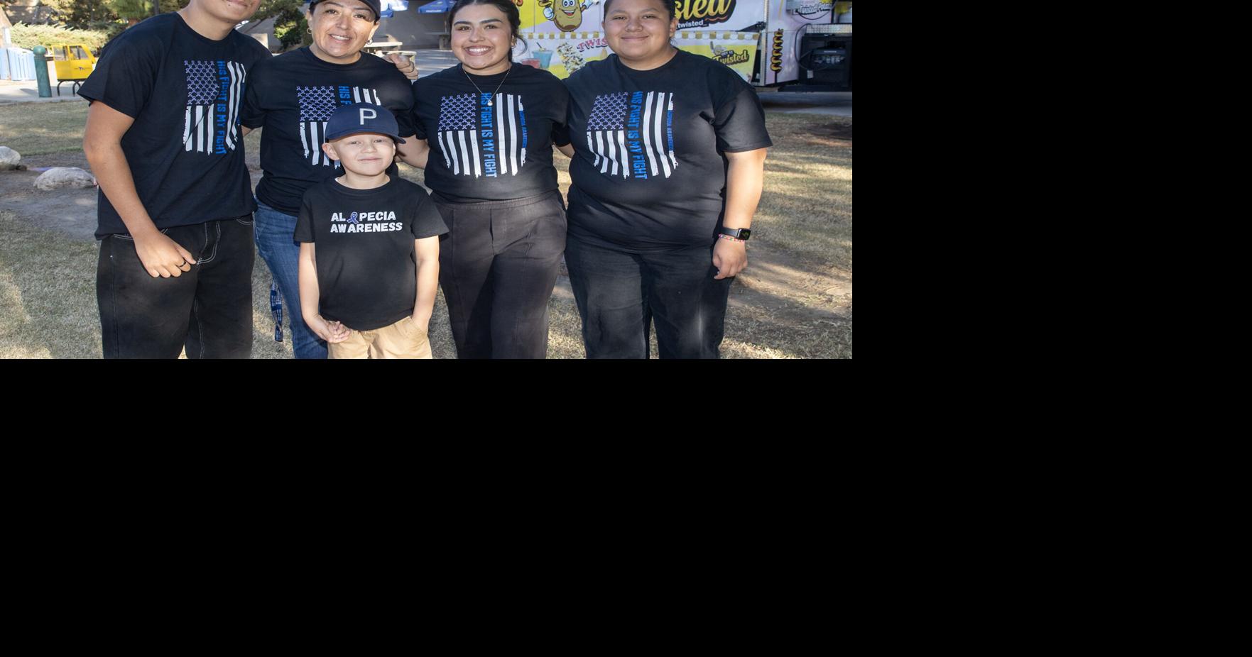 SNAP! — Walk for Alopecia | Bakersfield Life | bakersfield.com