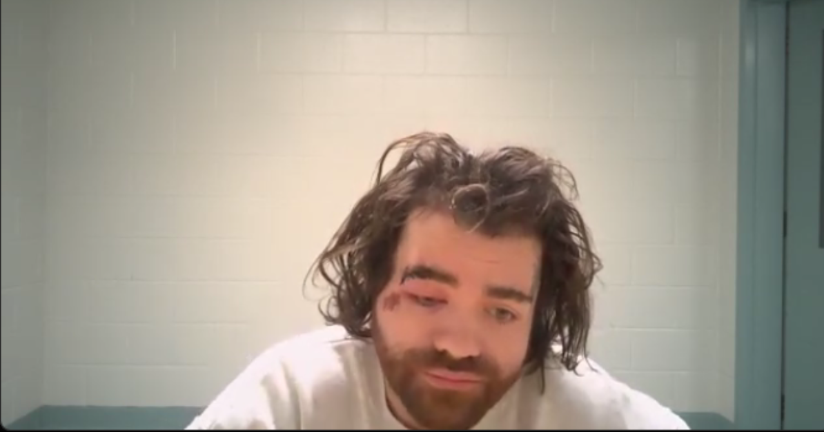 Wilmington man held without bail after alleged assault, siccing dog on ...