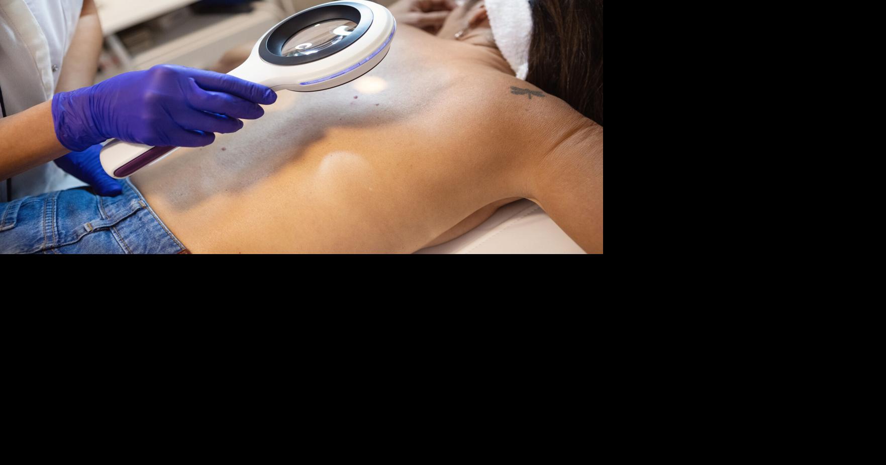 Your tan could cost you more than you think | Business | The Berkshire ...