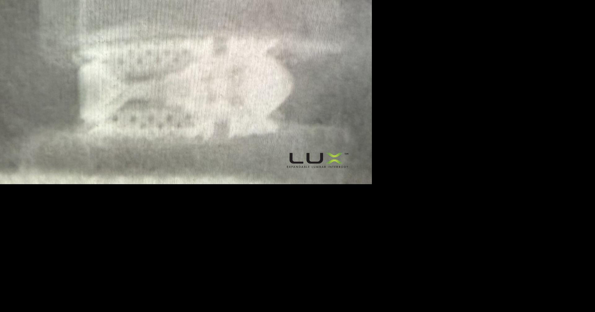 Xenix Medical Announces FDA Clearance and Full Commercial Launch of the ...