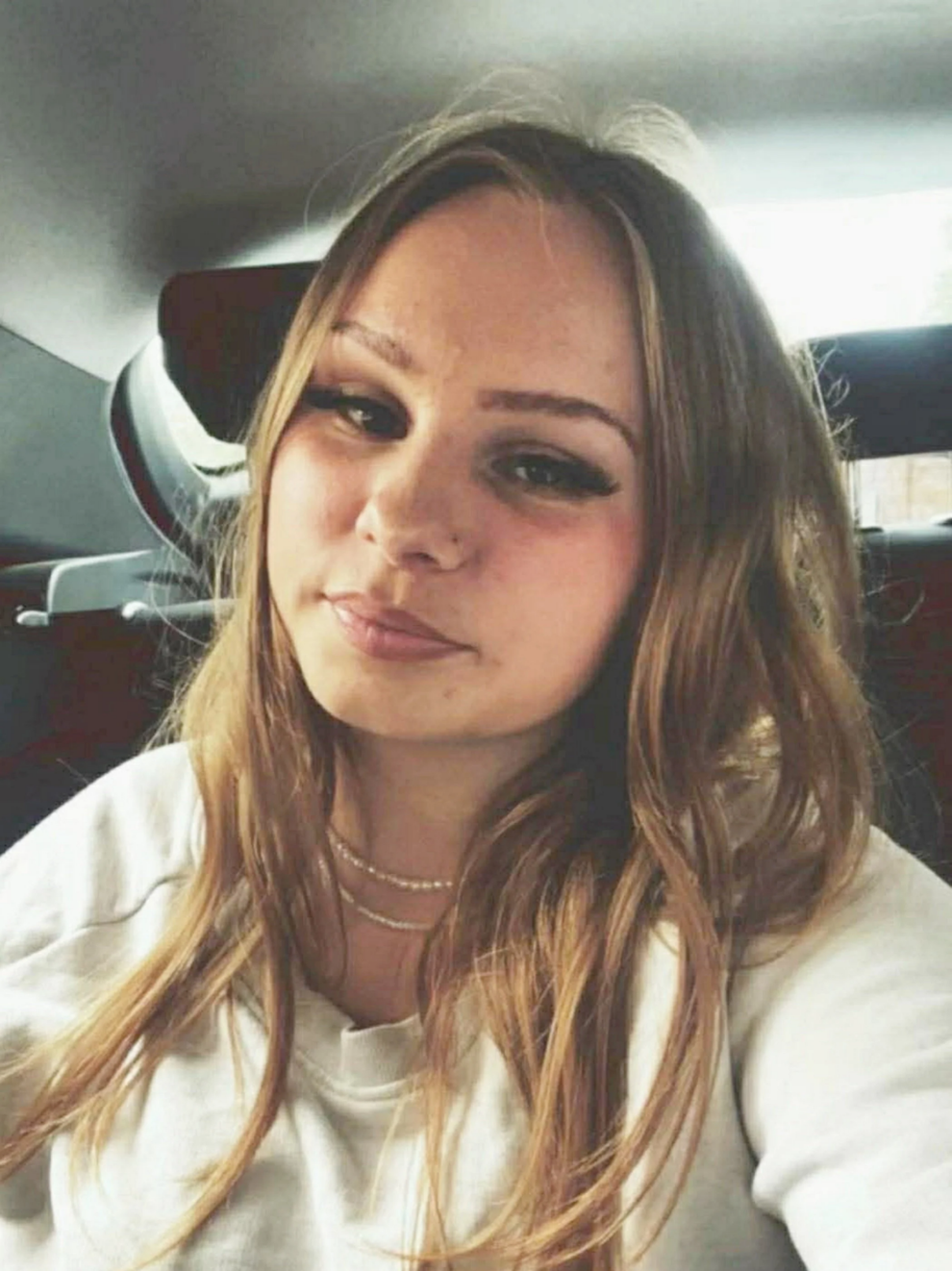 Teen’s spinal stroke dismissed as ‘period pain’ | Health ...