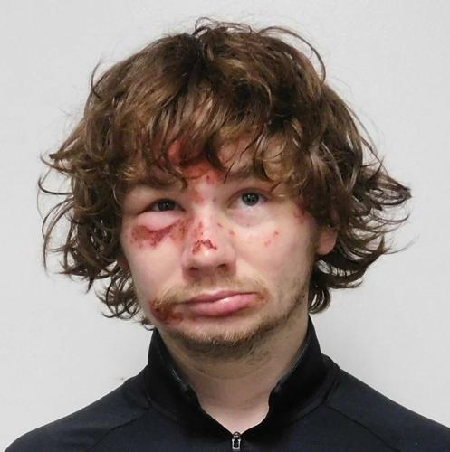 Prosecutors Give Suspended Sentence To Robber | Local News ...