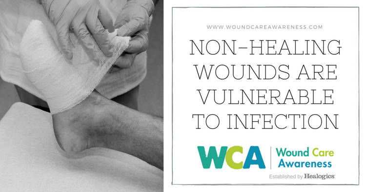 Weeks Wound Healing Center Celebrates Wound Care Awareness Week ...