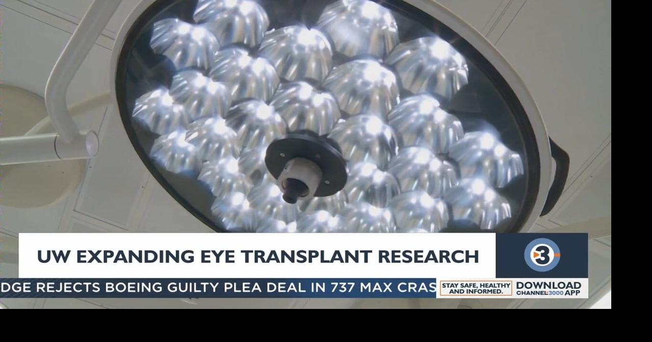 UW is expanding on eye transplant research | Video | channel3000.com