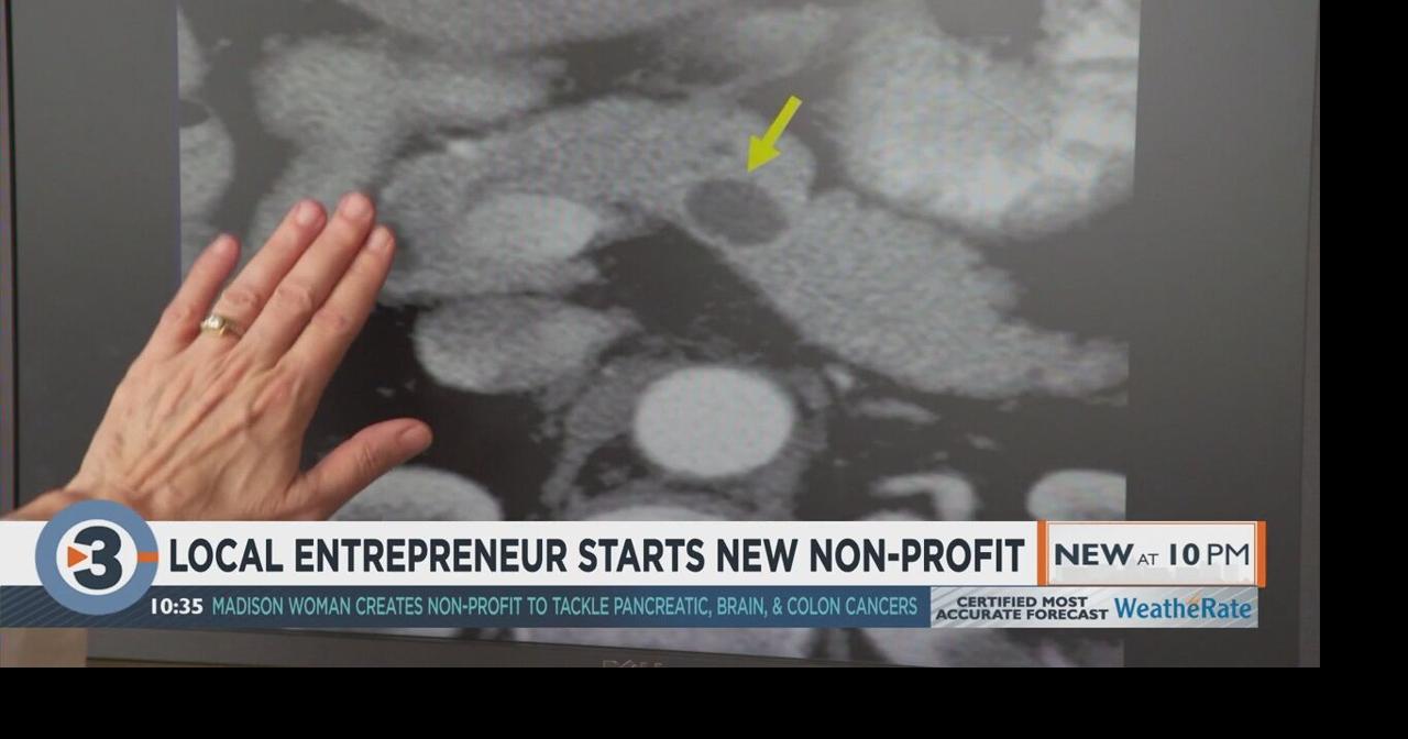 Madison woman creates non-profit to tackle pancreatic, brain, & colon ...