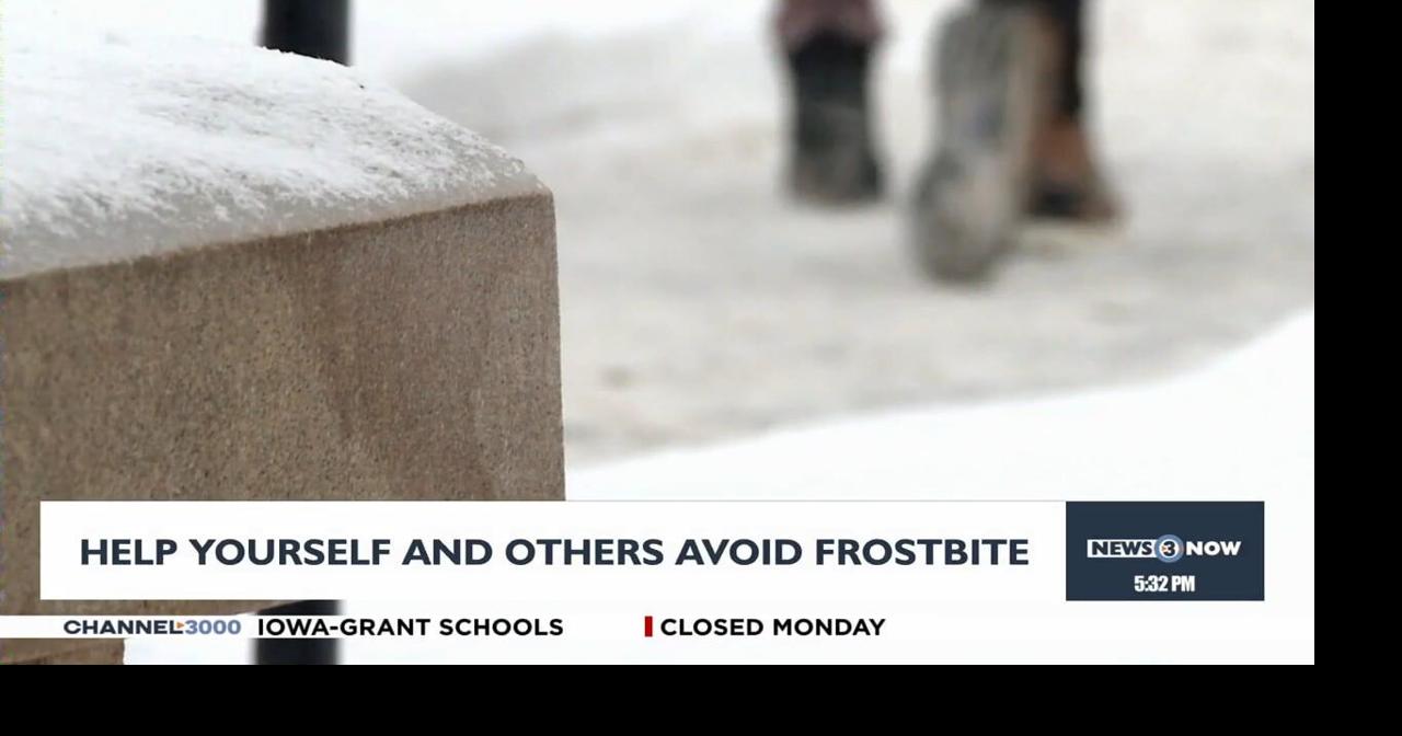 How to help yourself and others avoid frostbite | Health news ...