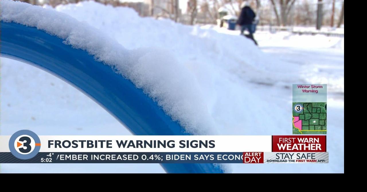 How to prevent and treat frostbite amid extreme cold | Health news ...