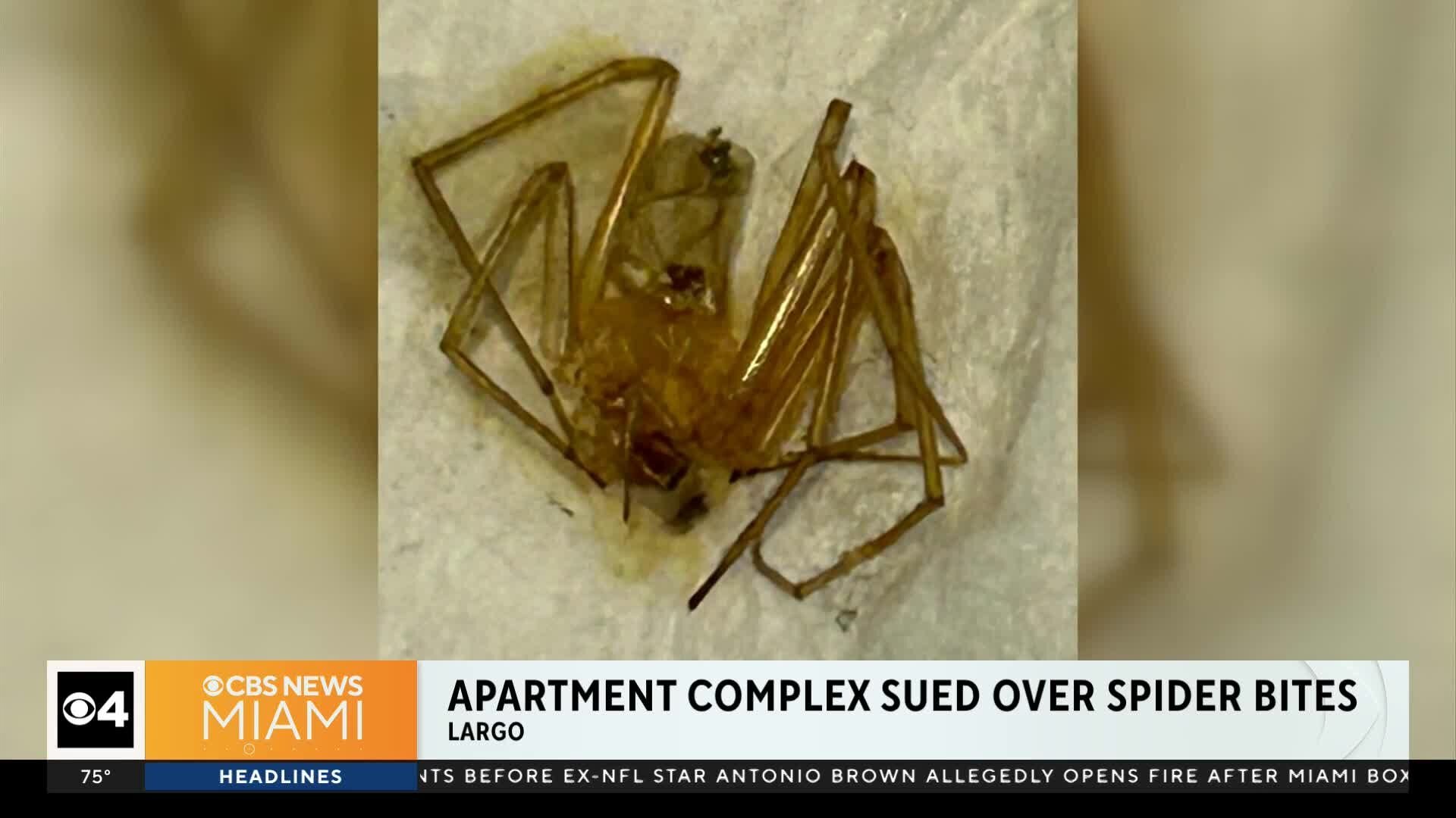 Woman says repeated spider bites inside her apartment led to toe ...