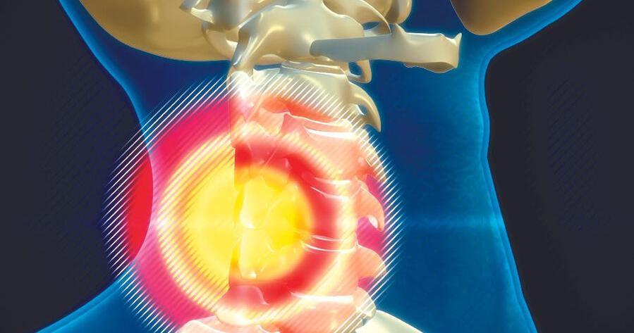Reverse 'tech neck' and improve posture | Health | chronicleonline.com