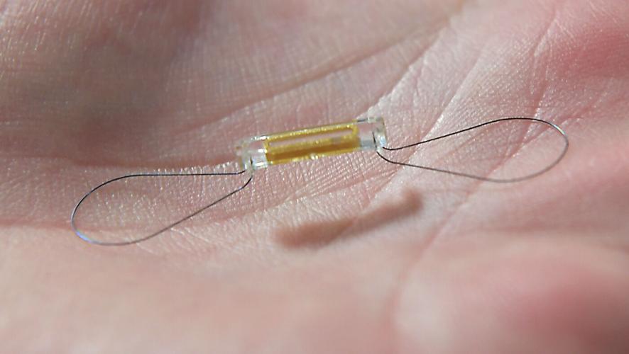 Hospital performs county’s first implant of wireless heart monitoring ...