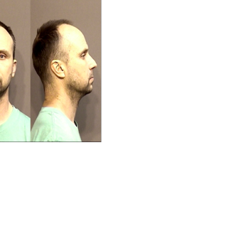 Man accused of installing video cameras in the Columbia Public Library ...