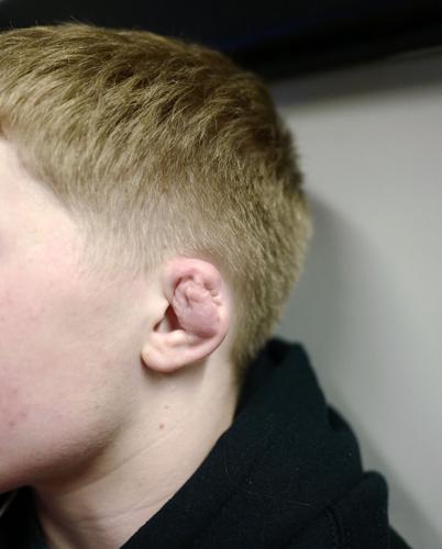 Jet Brown shows his cauliflower ear | Sports | columbiamissourian.com