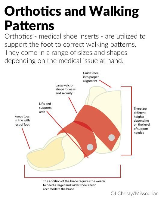 MU study explores how to improve footwear for people with disabilities ...