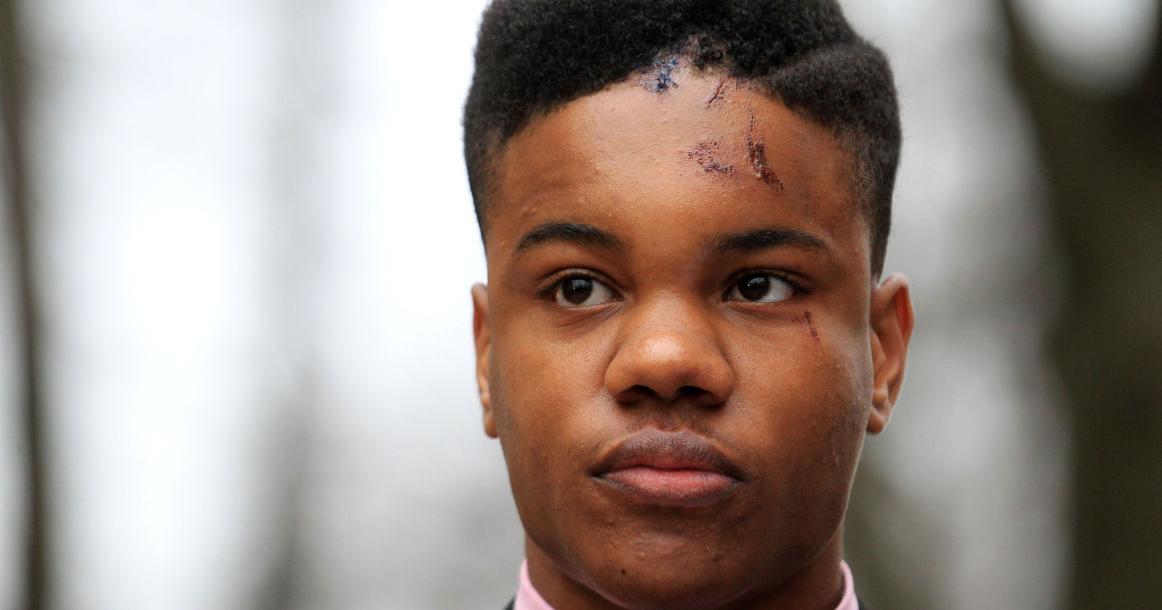 Press Conference for UVa Student Martese Johnson