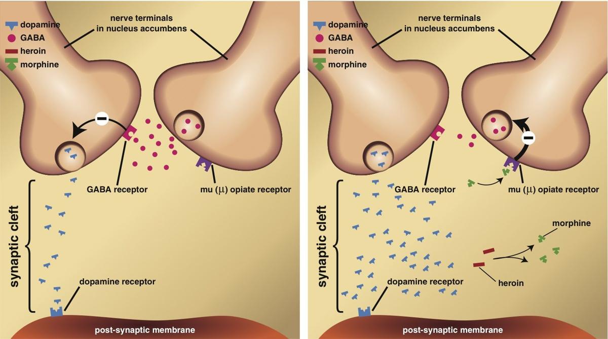 Heroin enhances brain’s natural sense of reward | News | dailyunion.com