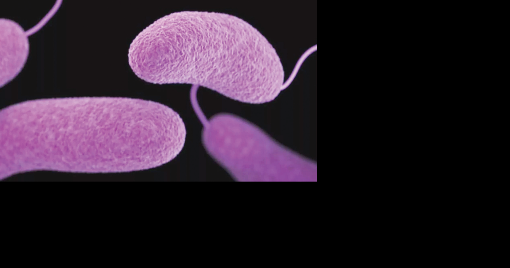 State health department: ‘Flesh-eating’ bacteria killed 4 this year ...