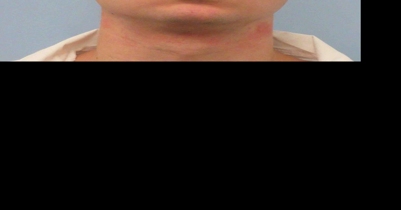 Department of Corrections: Inmate escapes from Decatur facility ...