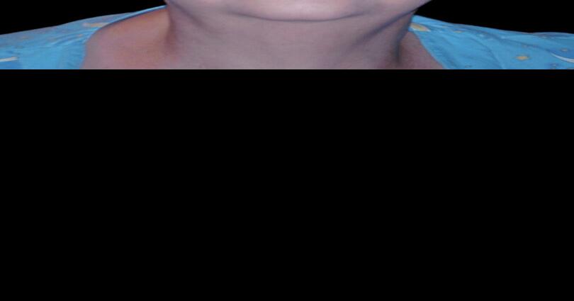 Norma Jean Brazeal | Obituaries | dentonrc.com