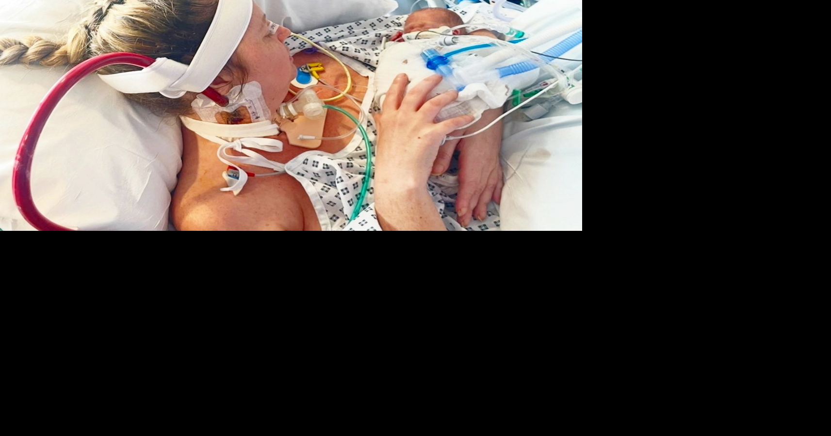 Mom reunites with premature baby after lung transplant | Health ...