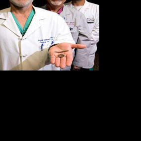 Linx procedure assists the body in fighting GERD | Lifestyle | djournal.com