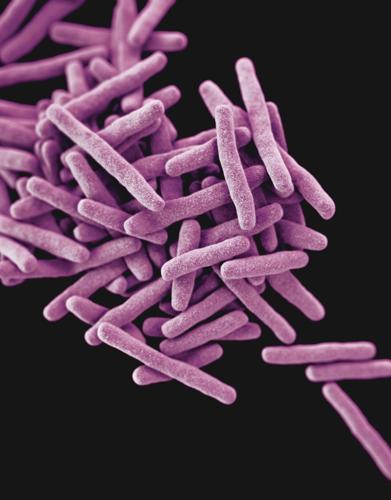 Bacteria frozen for thousands of years in ice cave is resistant to 10 ...