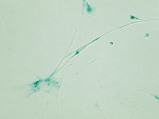 'Zombie cells' buildup in your body may play role in aging | | ehextra.com