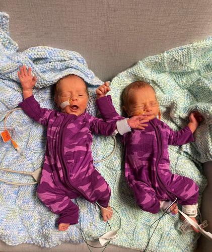 Anderla twins face surgery in the womb; Menominee mom delivers boys 3 months later | News ...