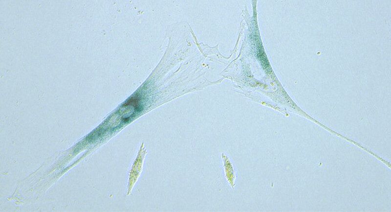 'Zombie cells' buildup in your body may play role in aging | | ehextra.com