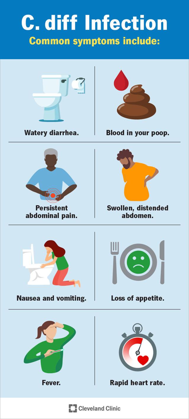 What to know about C. diff in medical settings | Medical Section ...