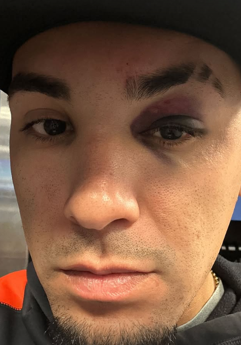 VIDEO: Javier Báez recibe pelotazo en el rostro durante partido en ...