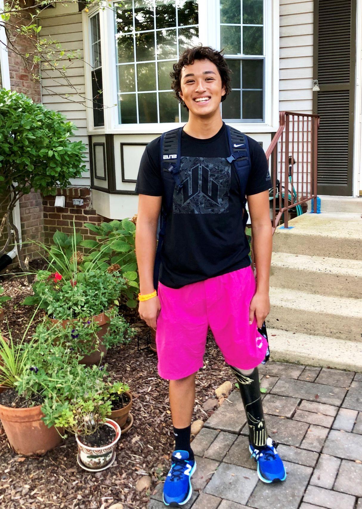 Prosthetic foot helps Edison football player pursue passion | Articles ...