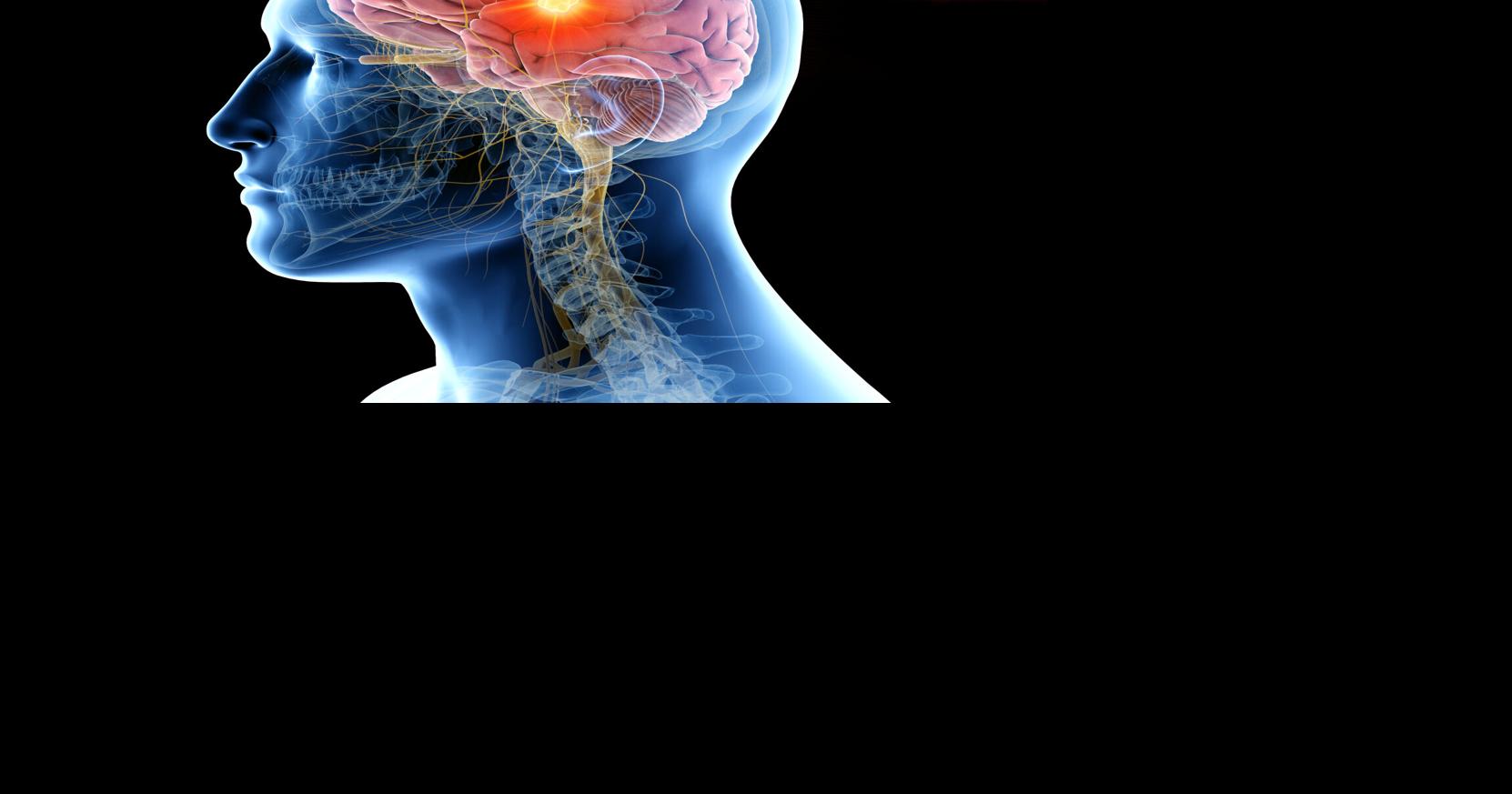 Inova is first in DMV to offer new therapy for brain tumors | Health ...