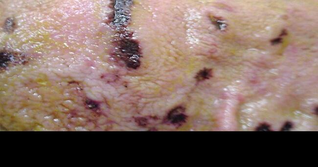 Abomasal Ulcers in Cattle | Cow/Calf Corner | feedlotmagazine.com