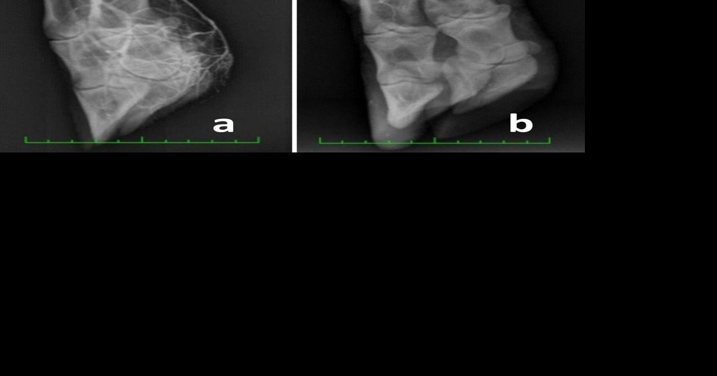 Fescue Foot Reported in Missouri Cattle | Cow/Calf Corner ...