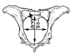 Pelvic Area Measurements in the Management of Replacement Heifers | Cow ...
