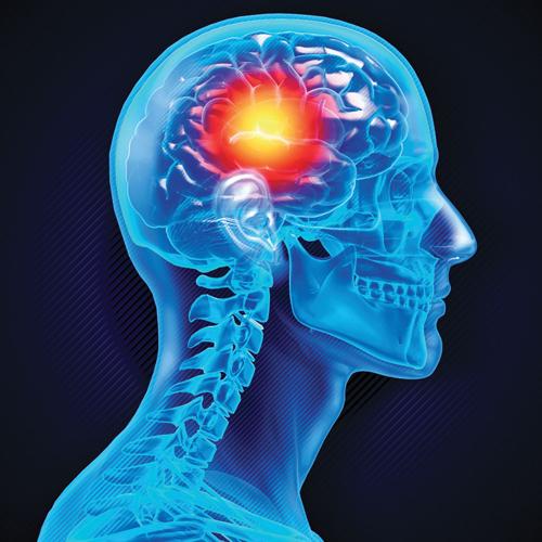 Think ahead, March is Brain Injury Awareness Month | Editorial ...