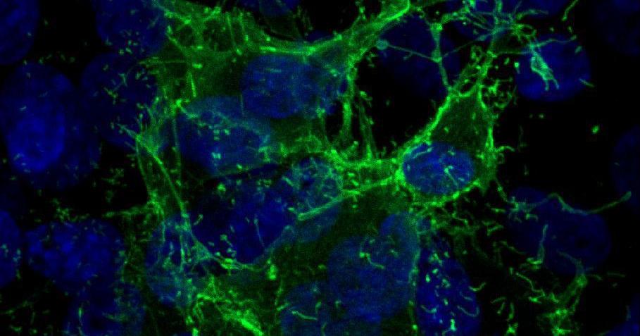 Fort Detrick virologists, Frederick-based company behind new drug for ...