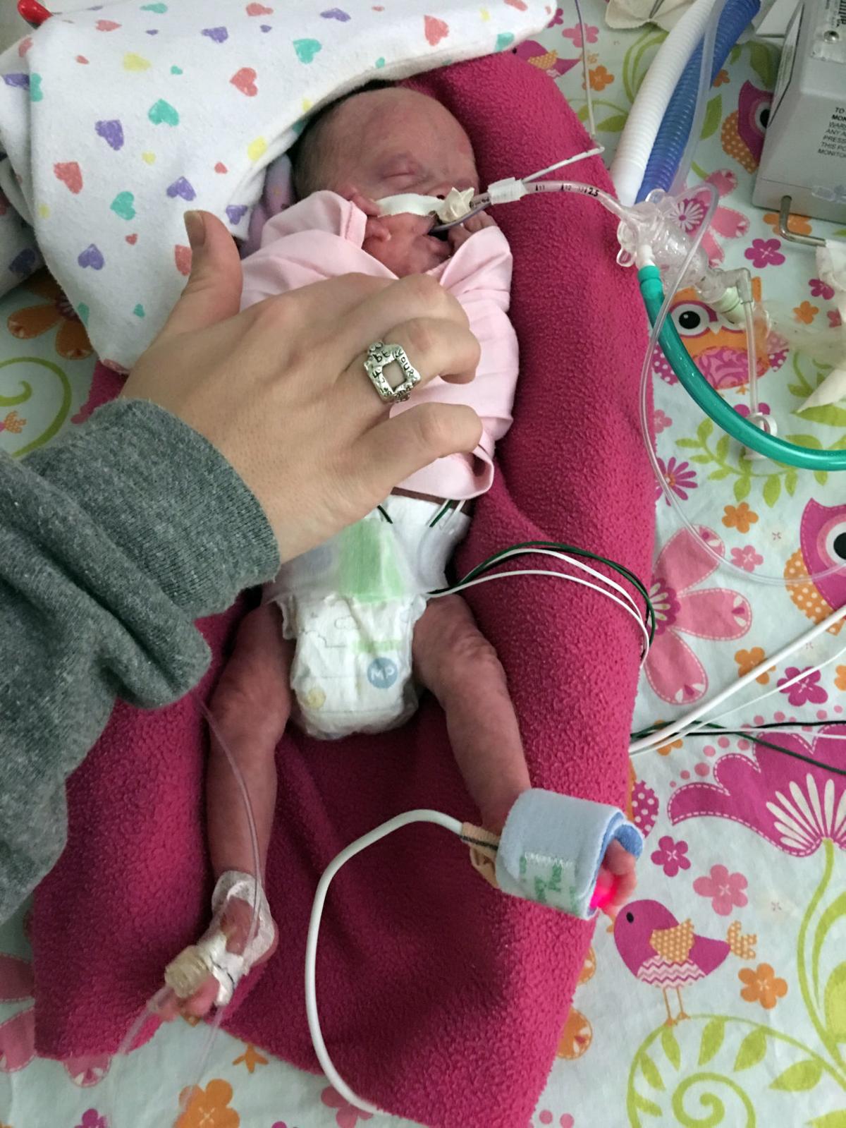 Identical Twin Girls Among Youngest Born In Iowa Health identical-twin-girls-among-youngest-born-in-iowa-health