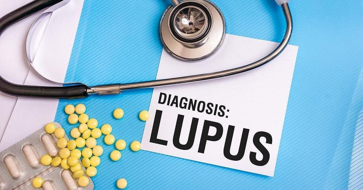 Understanding Lupus: Symptoms, Risks and New Advances in Treatment ...