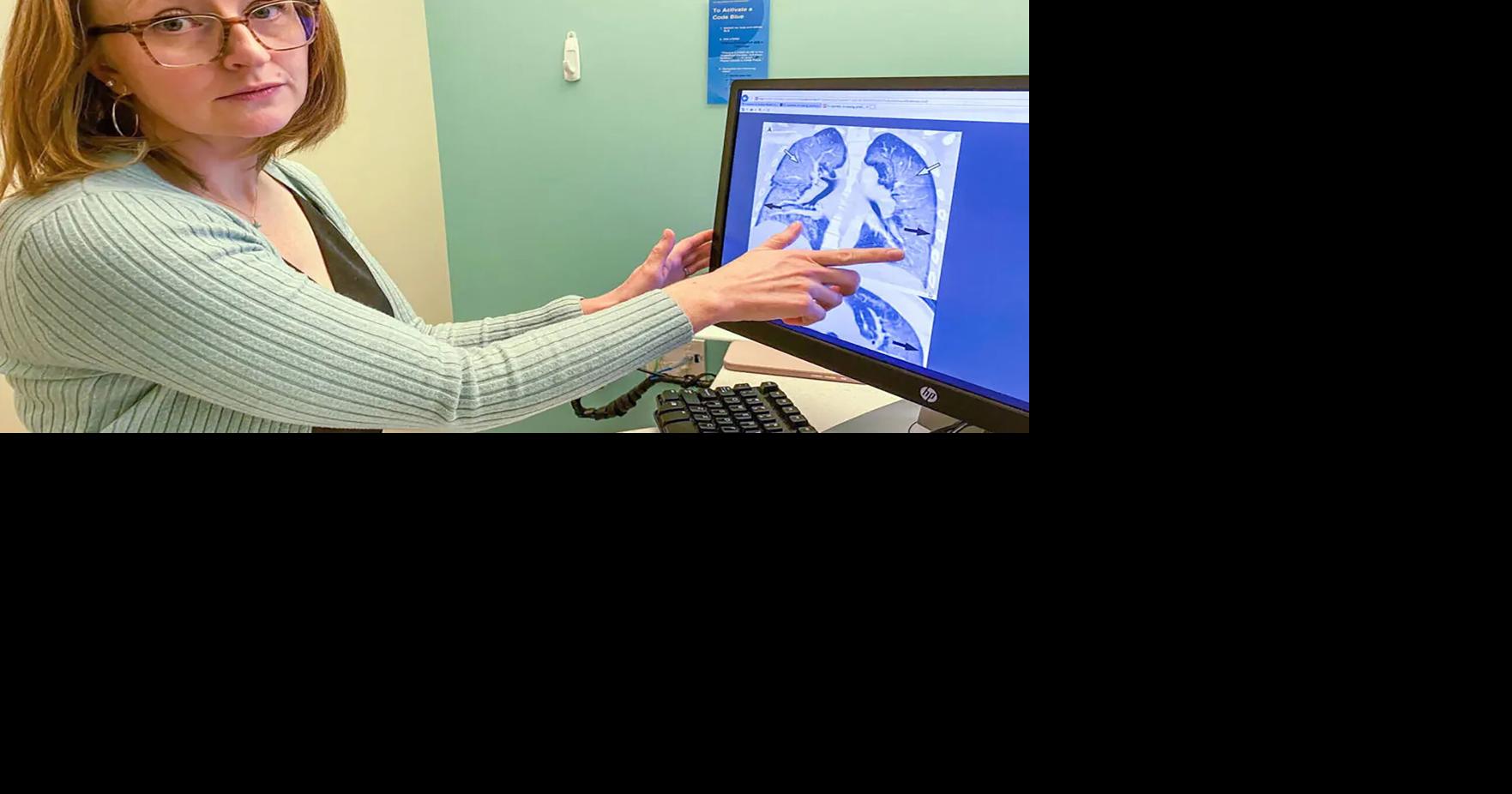 Many young adults who began vaping as teens can’t shake the habit | Health | gmtoday.com