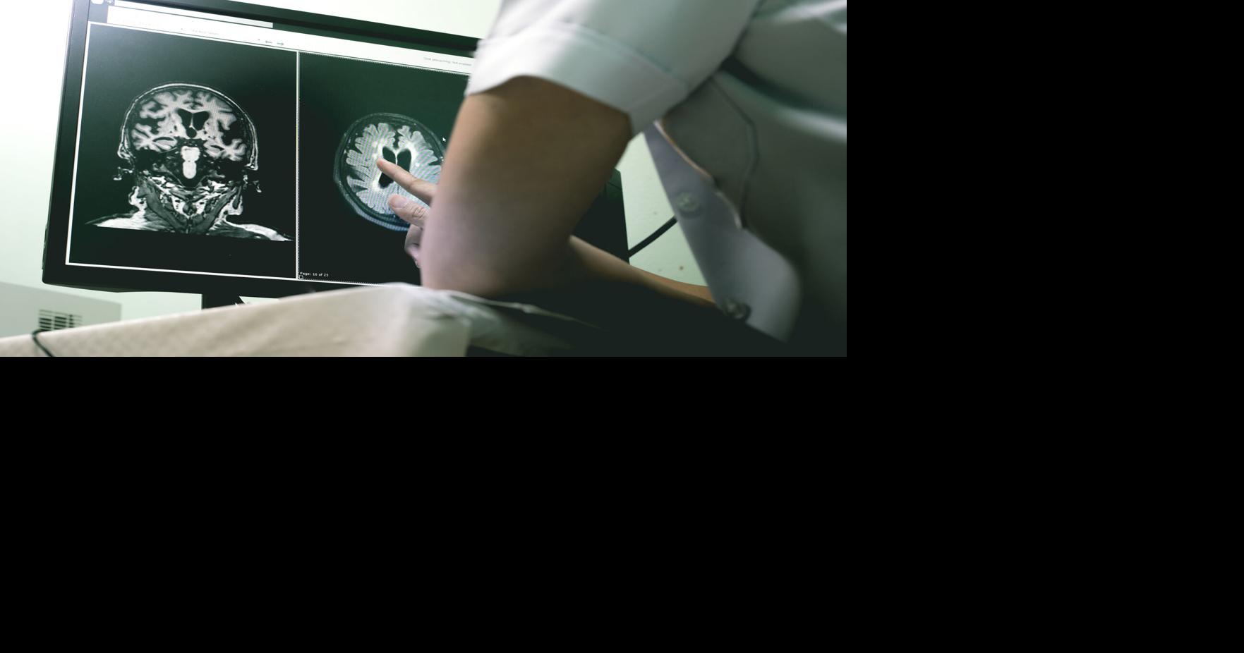 Alzheimer’s disease study: Boston researchers create at-home smell test ...