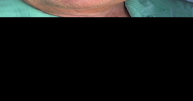 Stephen “Steve” M. Schaefer, 74 | Ozaukee County Obituaries | gmtoday.com